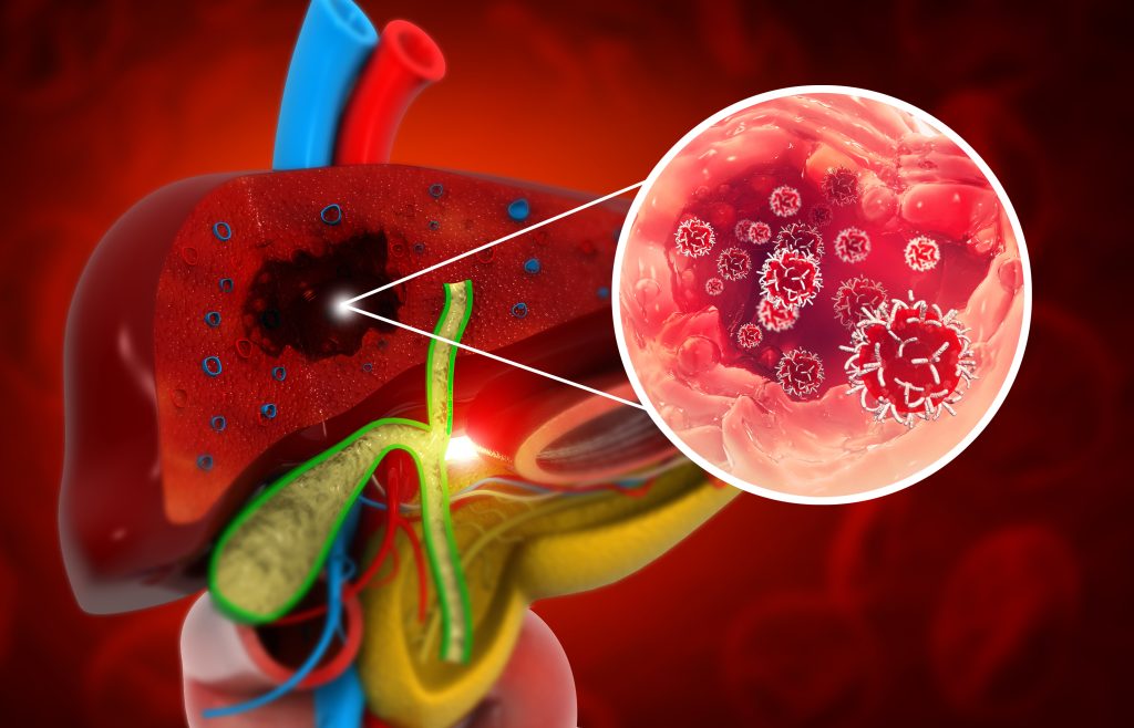 O Que São E Como Se Prevenir Contra As Hepatites Virais Saiba Blog